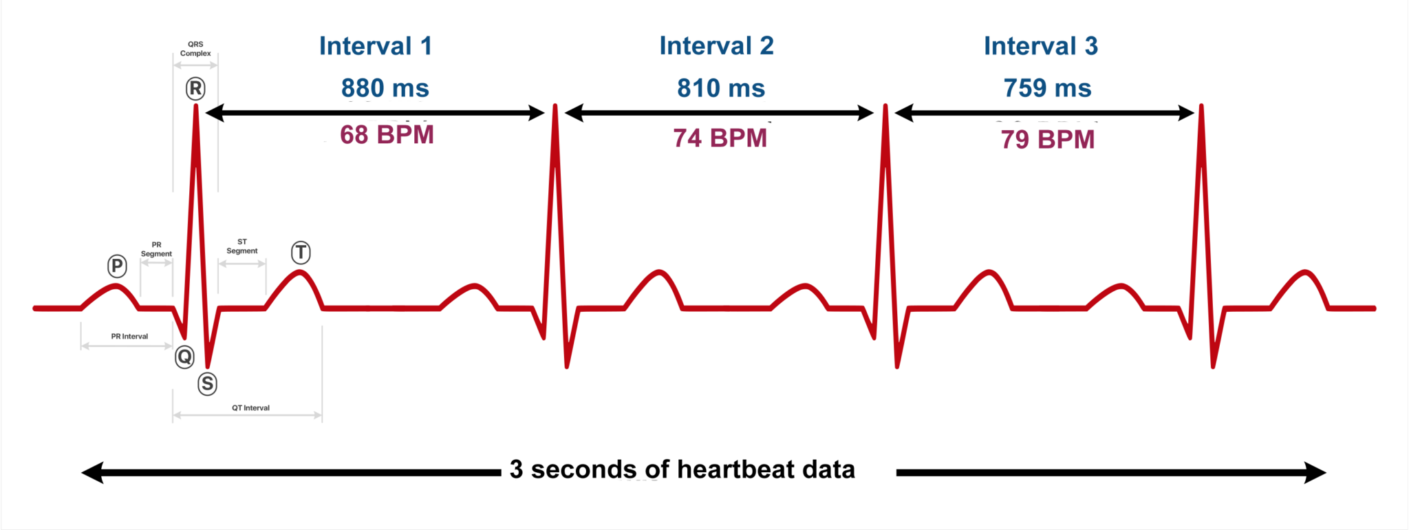 Heart Rate Variability metrics explained - Wellhero