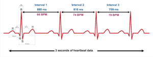 Heart Rate Variability metrics explained - Wellhero