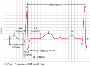 Heart Rate Variability metrics explained - Wellhero